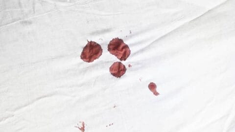How To Get Blood Out Of Sheets